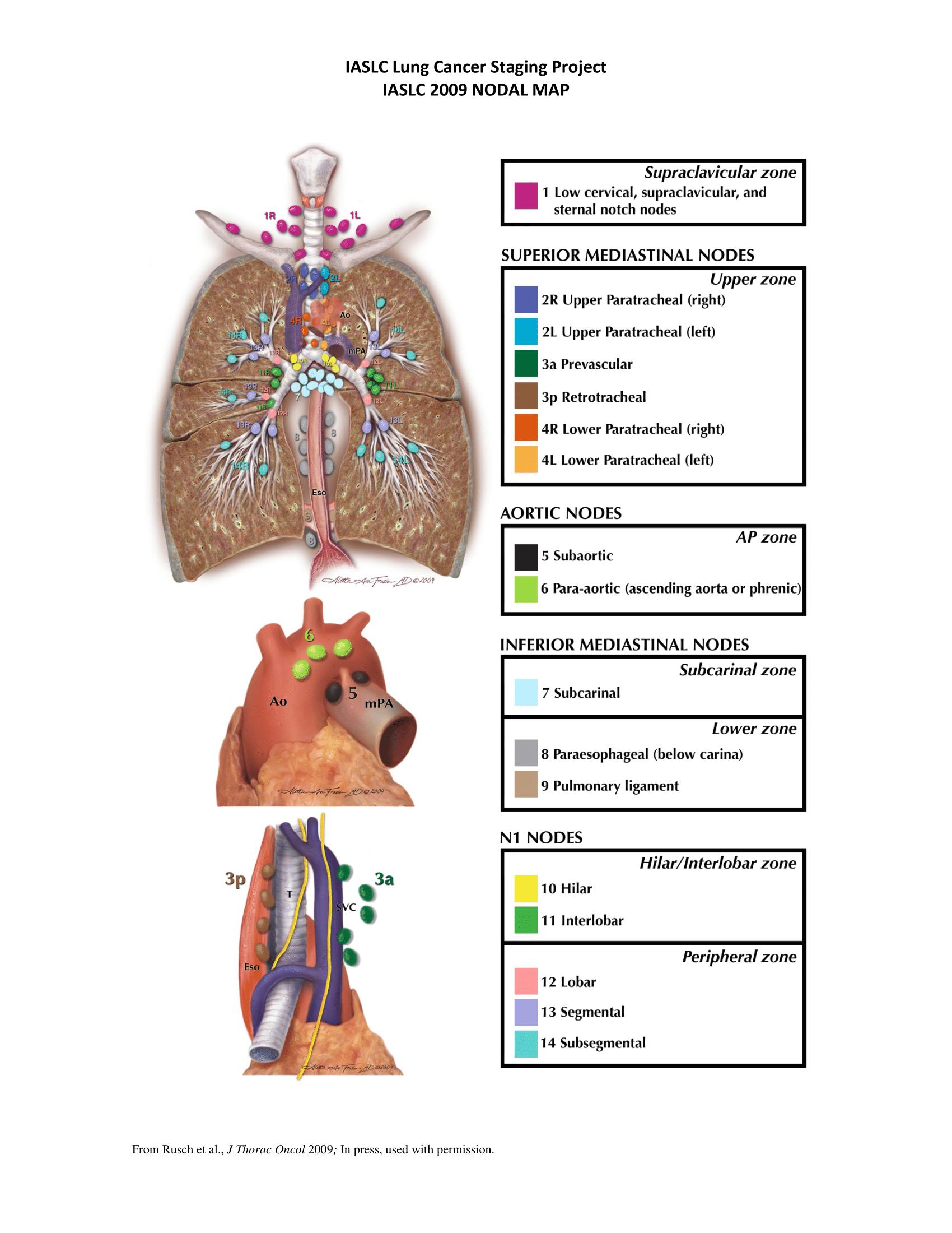 Diagnosis and Staging of Lung Cancer | Pearson's General Thoracic