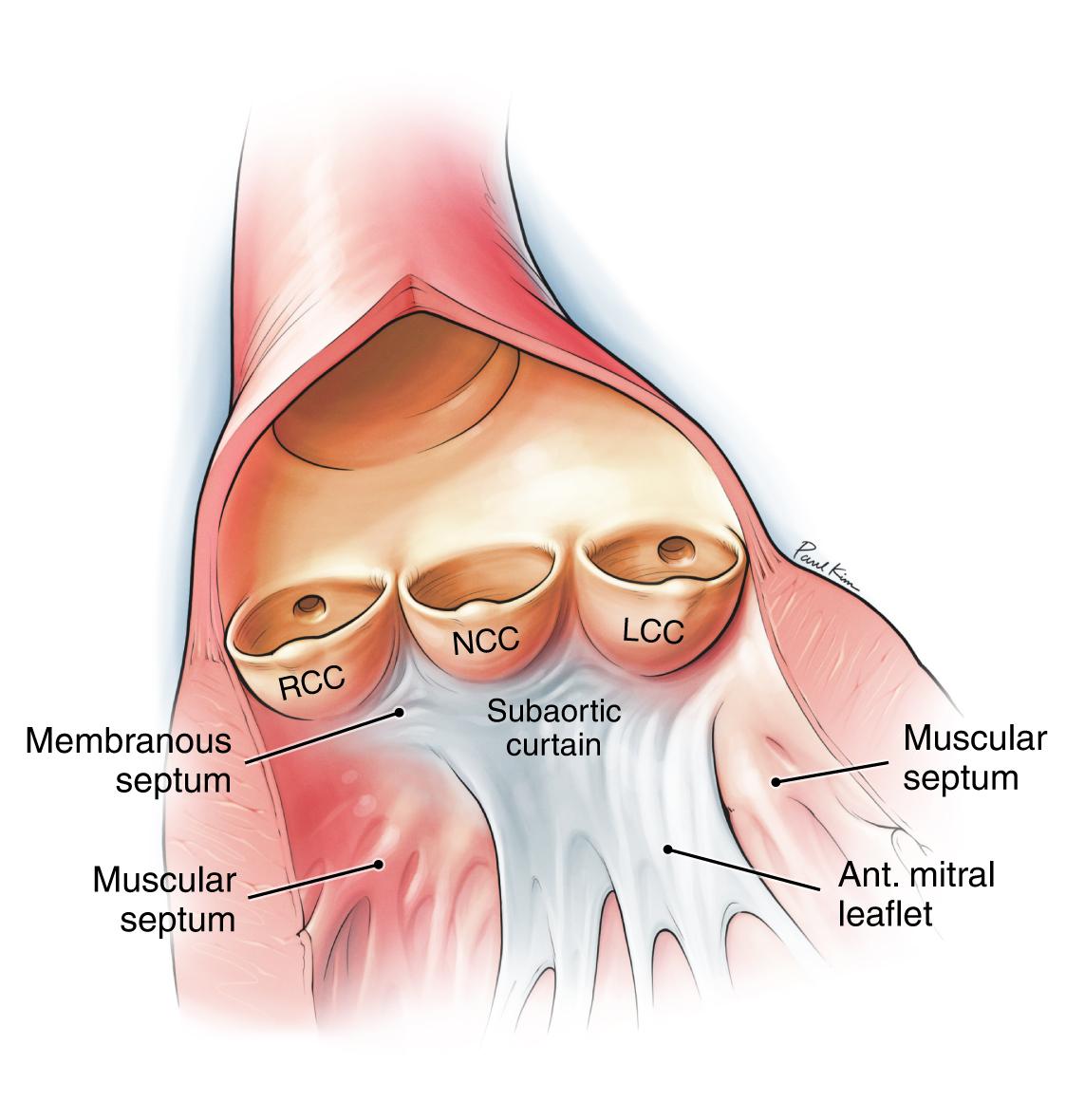 aortic valve annulus