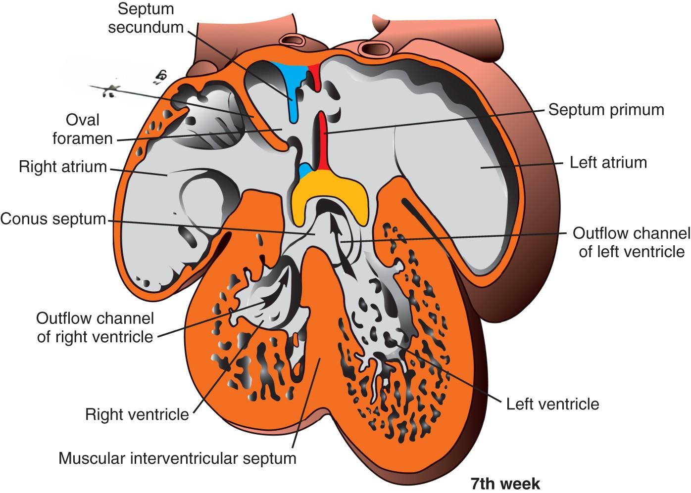 ventricular s